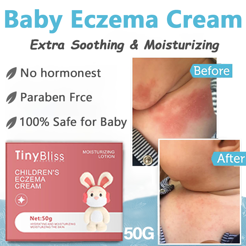 Tiny Bliss eczema cream Antiseptic Baby Skin Healing Cream Baby rashes ...