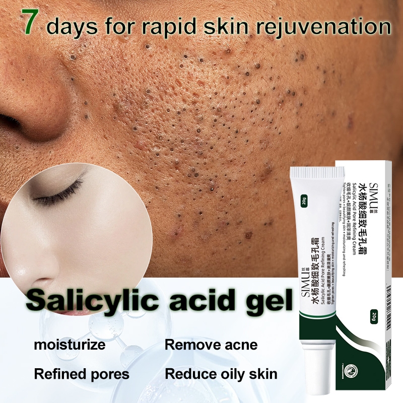 Salicylic Acid Pore Refining Cream 20g Dissolves blackheads shrinks ...