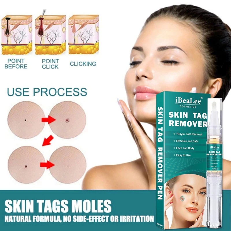 Skin Tag Remover Pen Painless Fast Dark Spot Mole Warts Removal Serum ...