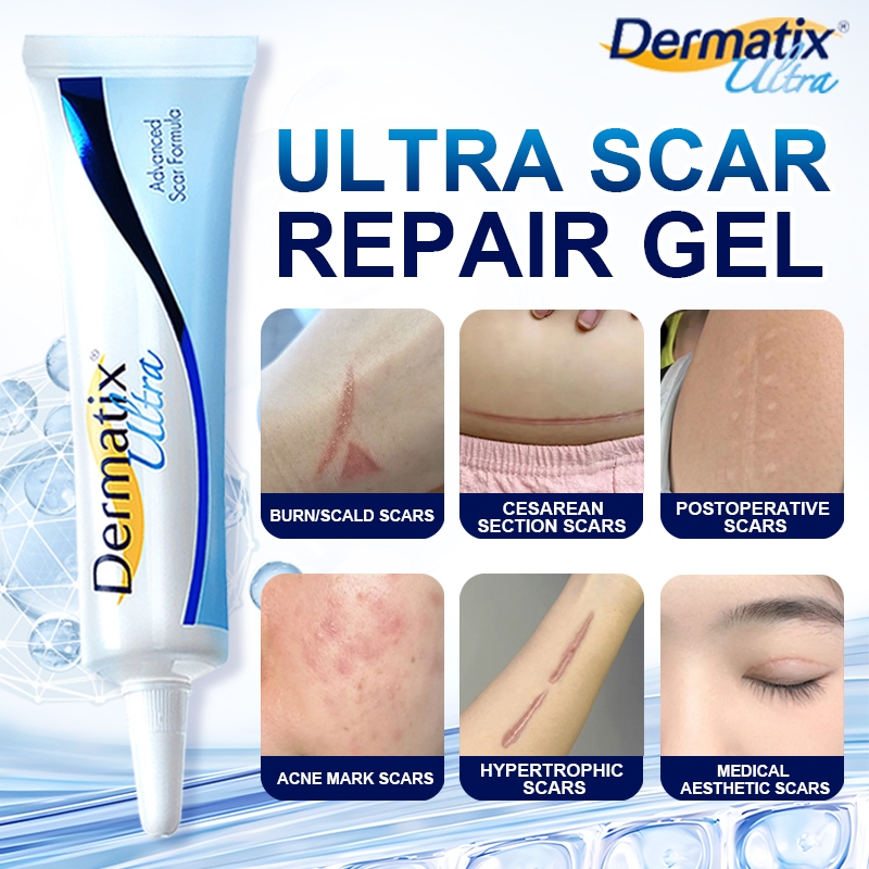 Dermatix Ultra Scar Repair Gel 15g Reduces Scar Redness Visibility ...