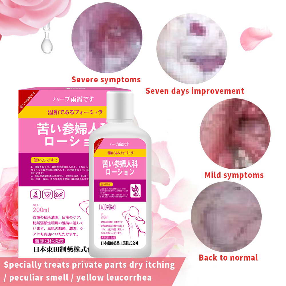200ml Feminine Intimate Wash Private Parts Antibacterial Vaginal ...