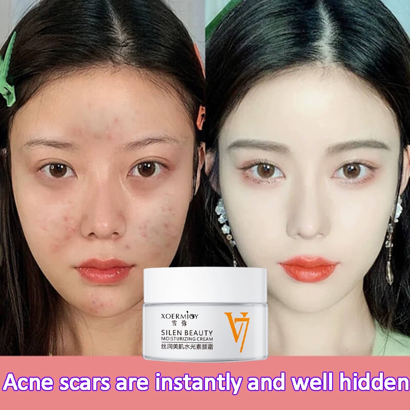 XOERMIOY Hydrating V7 No-Yan Cream Moisturizing Retouch Skin Tone ...
