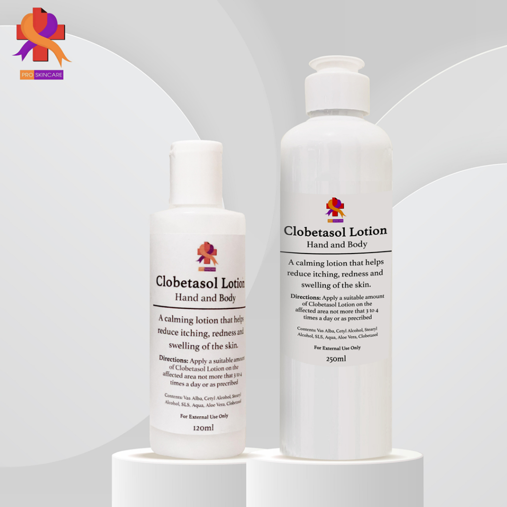 ANTI ICHY CLOBE-TASOL CALMING LOTION 120ML | Shopee Philippines