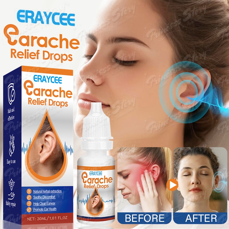 30ML Tinnitus liquid Ear Drops Treatment Original Ear Pain Liquid For ...