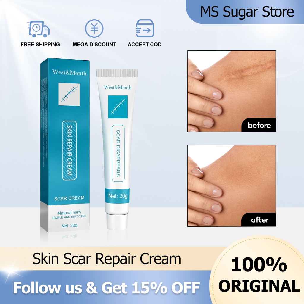 West&Month Scar Repair Ointment 20g Lighten Hyperplastic Scars ...