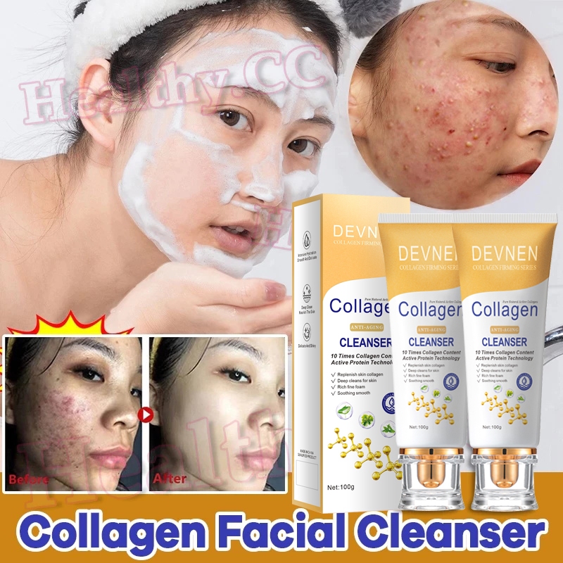 Collagen Cleanser Anti Acne Facial Wash 100g Whitening Remove Melasma ...