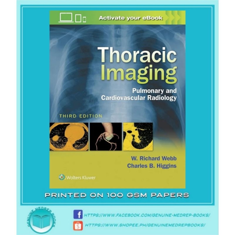 THORACIC IMAGING: PULMONARY AND CARDIOVASCULAR RADIOLOGY 3RD ED ...