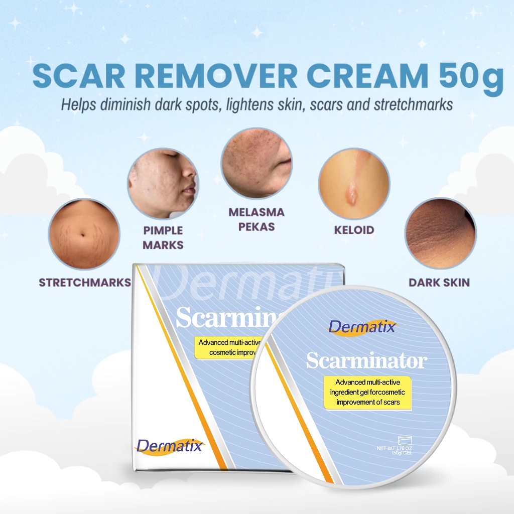 Scarminator Cream Original For Scar Peklat Stretch Mark Remover Skin ...