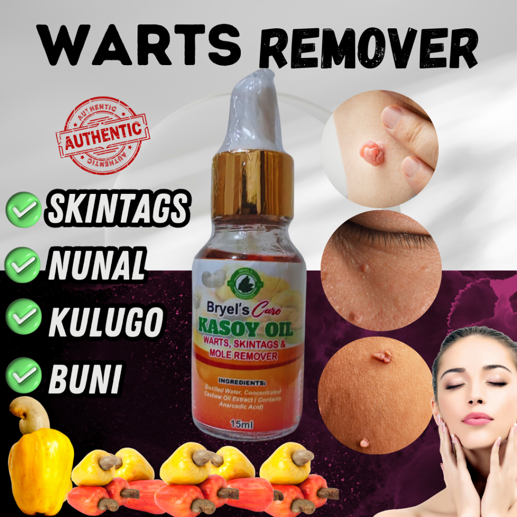 Bryel's Care Kasoy Oil Solution for Warts Skintags and Mole Remover ...