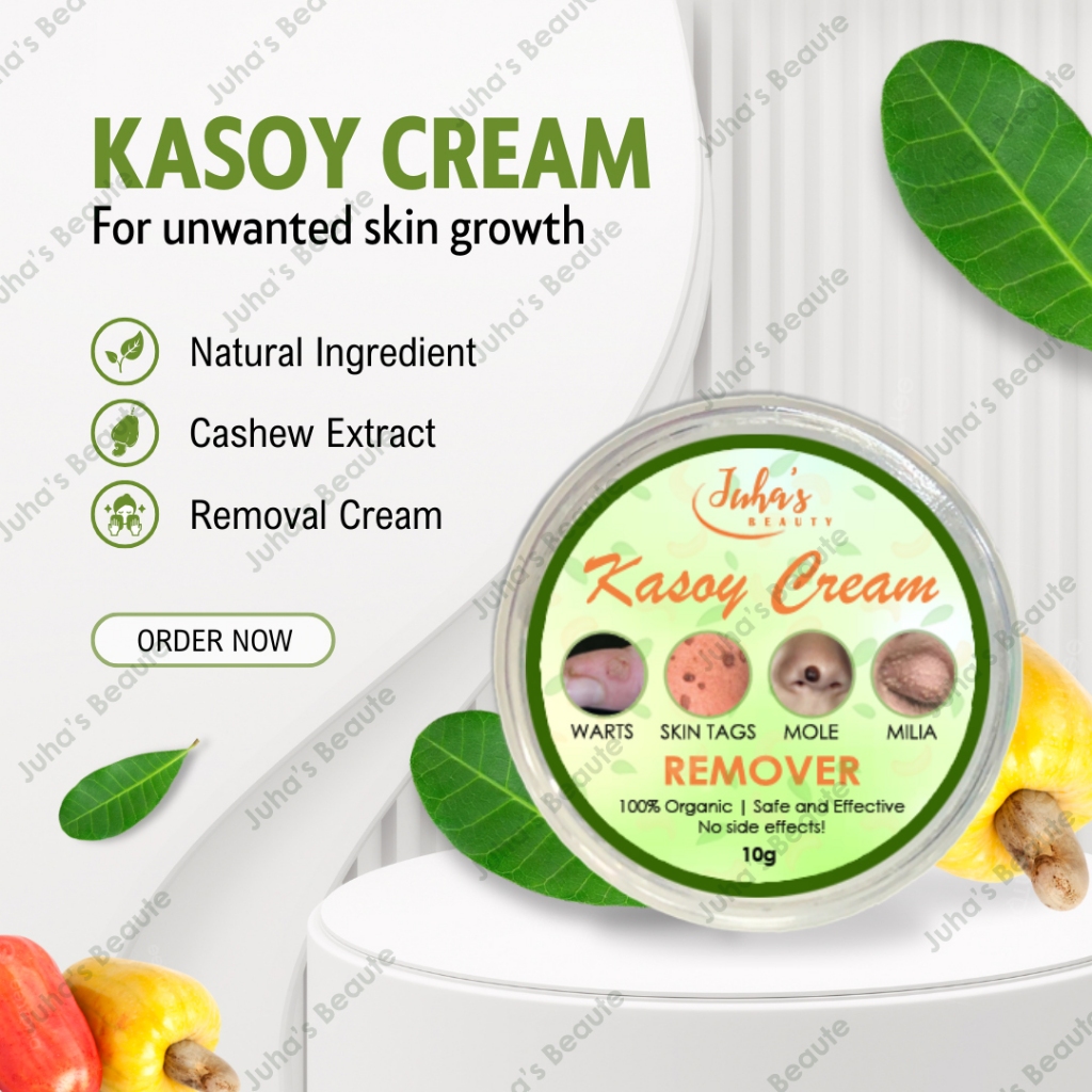 Kasoy Cream Remover 5g and 10g | Warts Remover | Skin Tag Remover ...