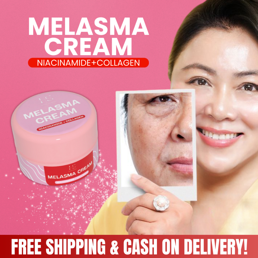 MELASMA CREAM (NIACINAMIDE + COLLAGEN) BUY1TAKE2 FOR ONLY 199 | Shopee ...