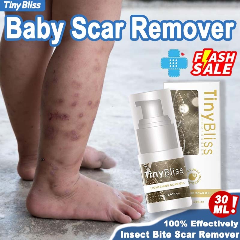 Tinybliss Ultra Gel Baby Scar Remover Peklat Removal Cream For Leg ...