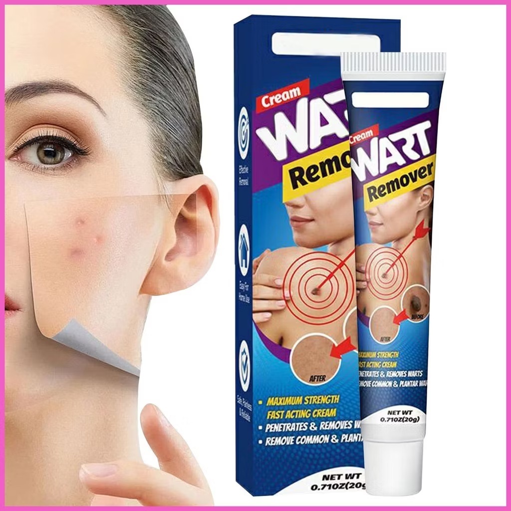 Warts Remover Original Cream Kulugo Skin Tags Mole Remover Warts ...