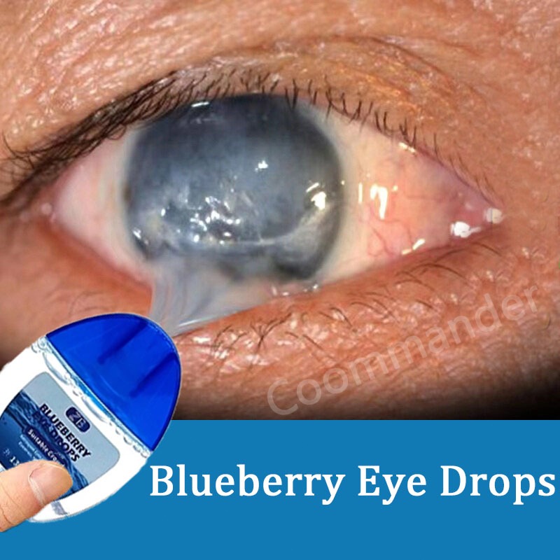 Blueberry Eye Drops original clear eye sight drops Itchy Eyes Glaucoma ...