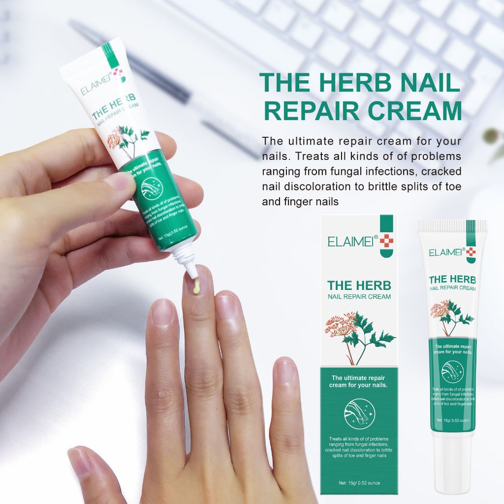Nail Repair Cream Anti Fungus Nails Treatment Ointment Anti-Fungal ...