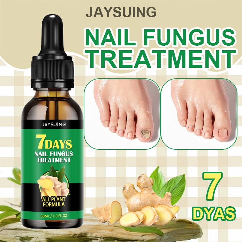 7 Days Nail Fungal Treatment Essential Oil Serum 30ml Onychomycosis ...