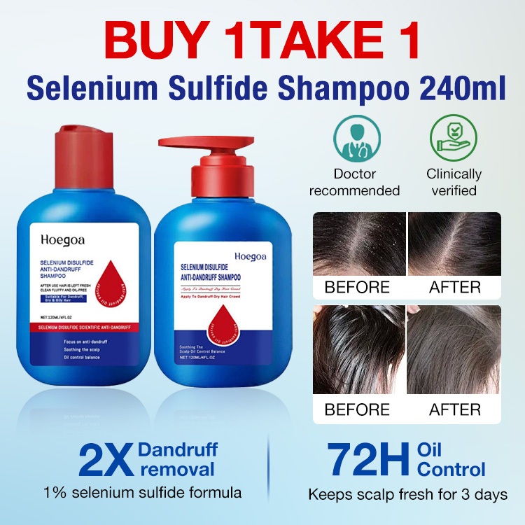 【Buy1Take1】Selenium Disulfide Shampoo Anti Dandruff Oil Control and ...