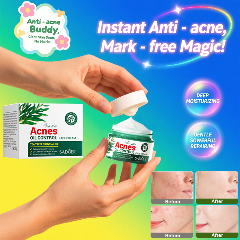 Pimple remover Fastly reduce acne marks anti acne Improve facial acne ...