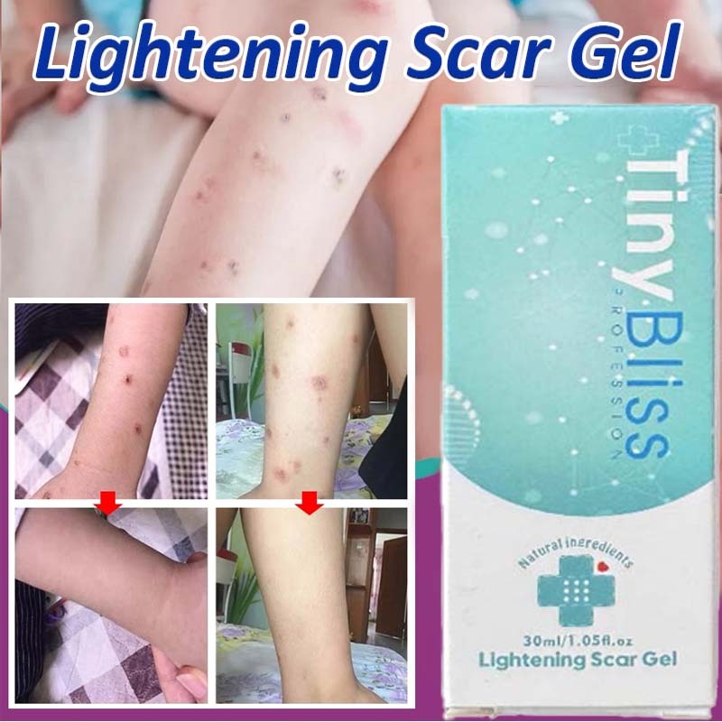 TinyBliss Lighten Up Lightening Baby Scar Gel Scar Remover Cream For ...