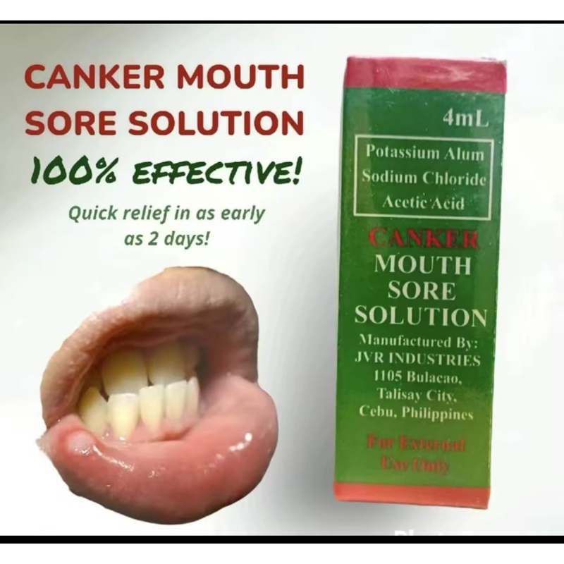 Canker mouth sore solution 100x effective made in CEBU | Shopee Philippines