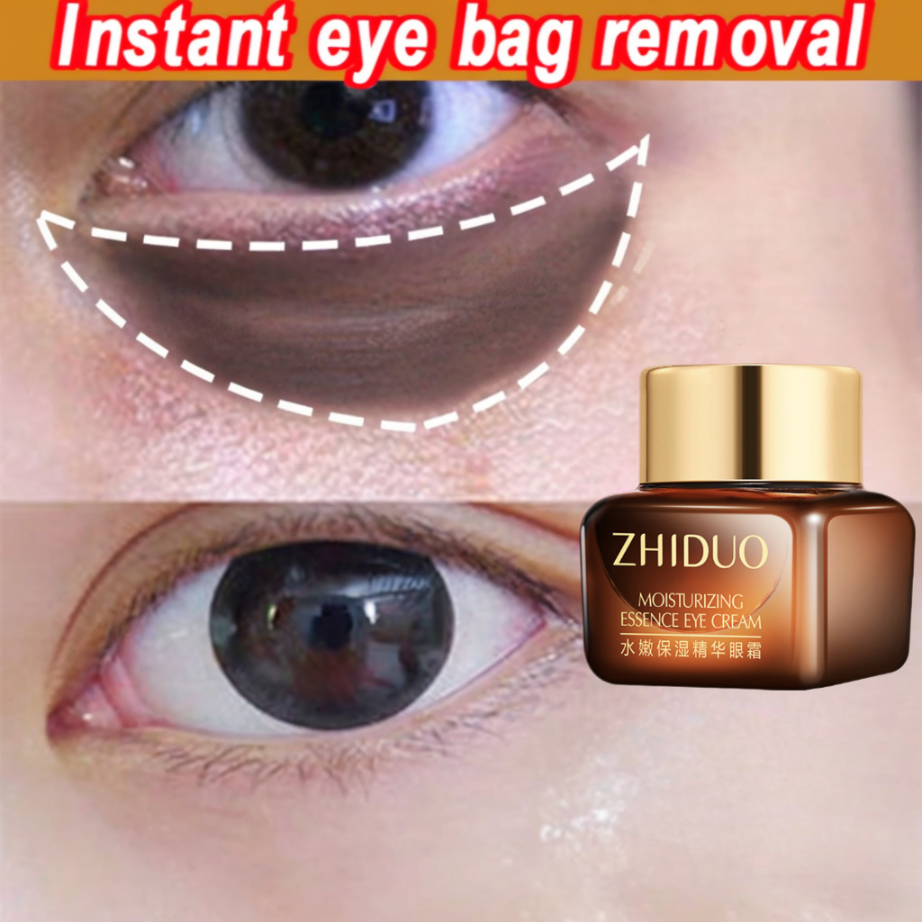 Retinol Eye Cream for dark circle eyebags remover dark circles ...