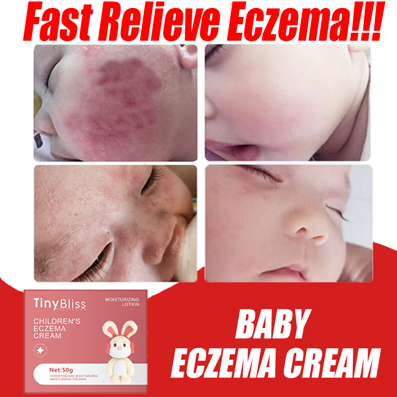 TinyBliss baby Eczema Cream Nappy Rash Relief Children Anti-Itch Cream ...