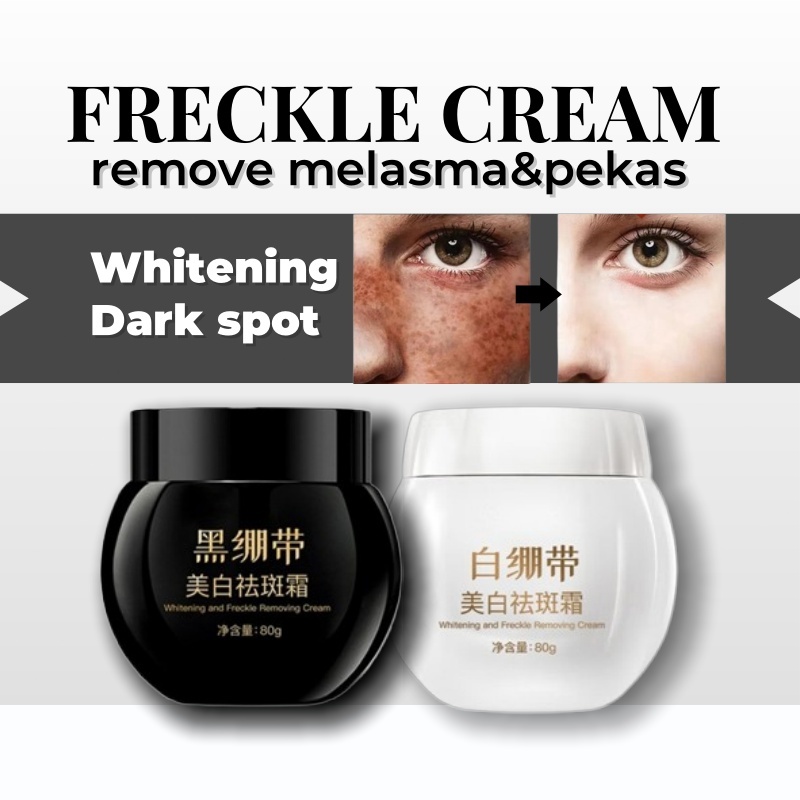 Melasma Cream Whitening Freckle Cream Spot Fading Removal Original High ...