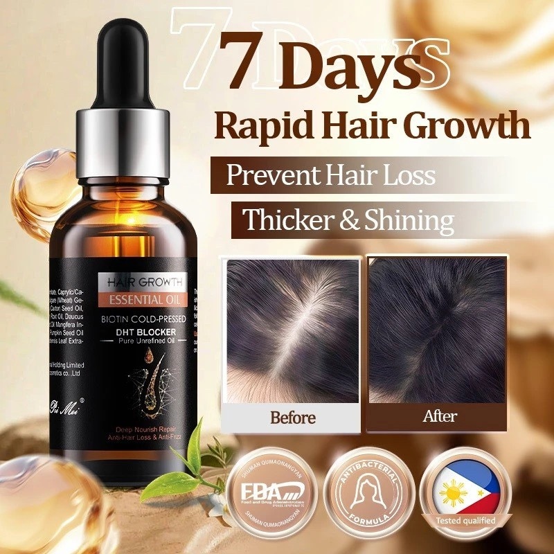 ORIGINAL Hair Grower Original Ginger Hair Growth Serum 7X Rapid Growth ...