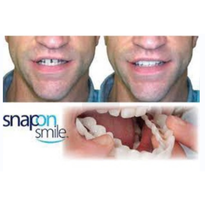 D8teeth fake teeth tooth pustiso teeth ngipin pustiso teeth original ...