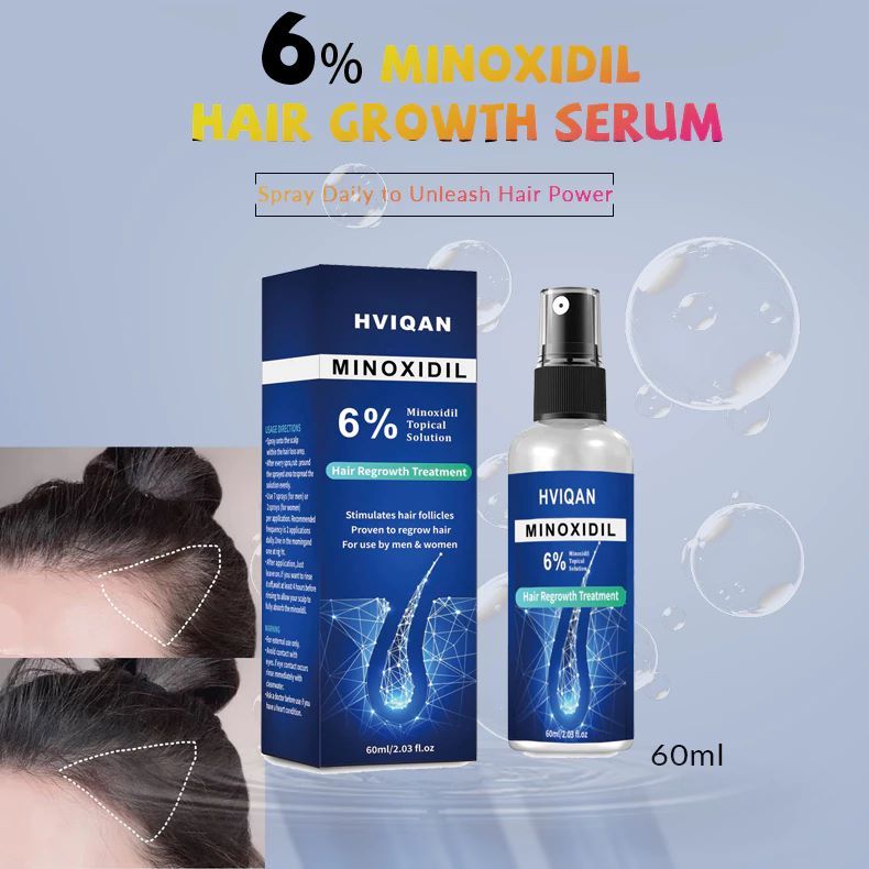 Minoxidil 6% Hair Growth Serum Fast Hair Growth Minoxidil Hair Grower ...