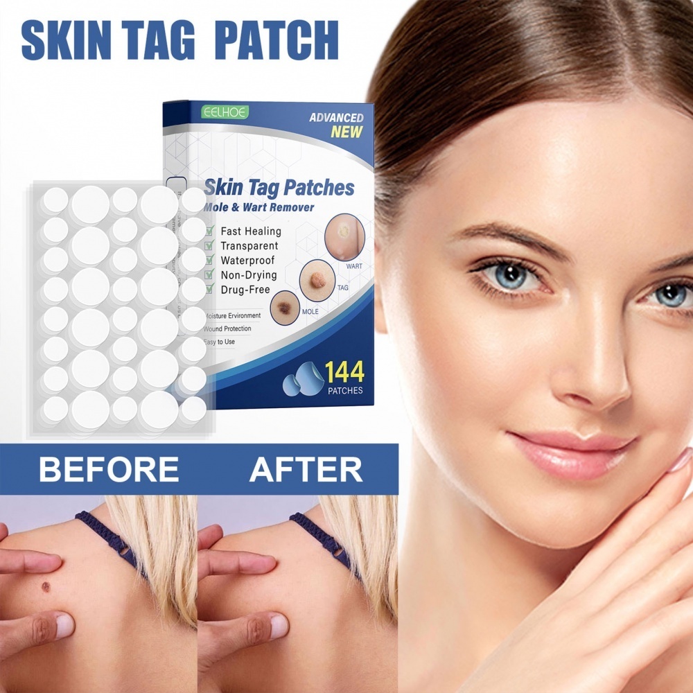 144PCS/Box Warts Remover Patch Safe Painless Skin Tag Remover Patch ...