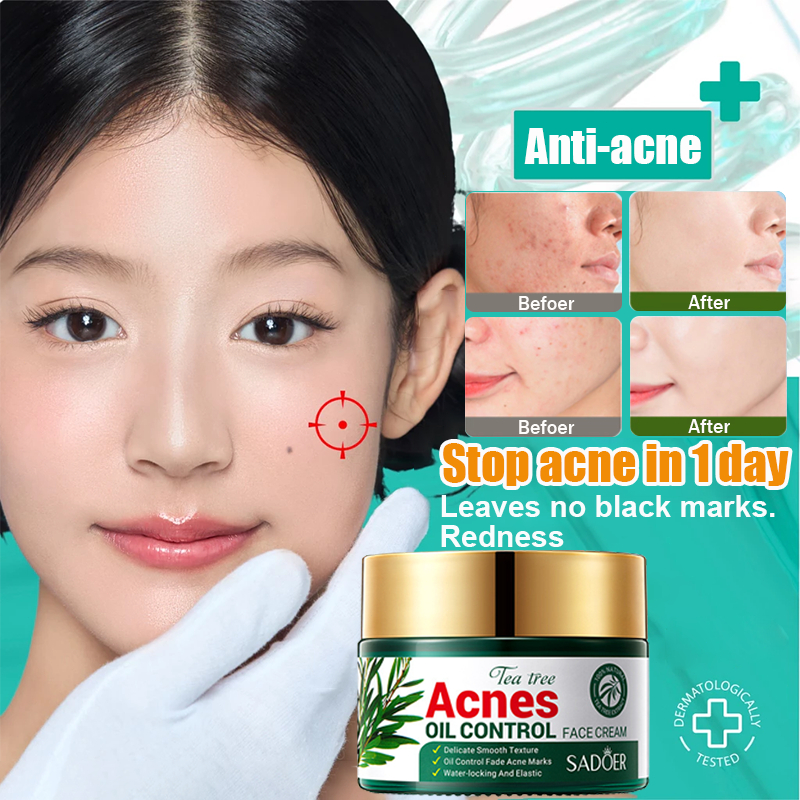 Pimple remover Fastly reduce acne marks anti acne Improve facial acne ...