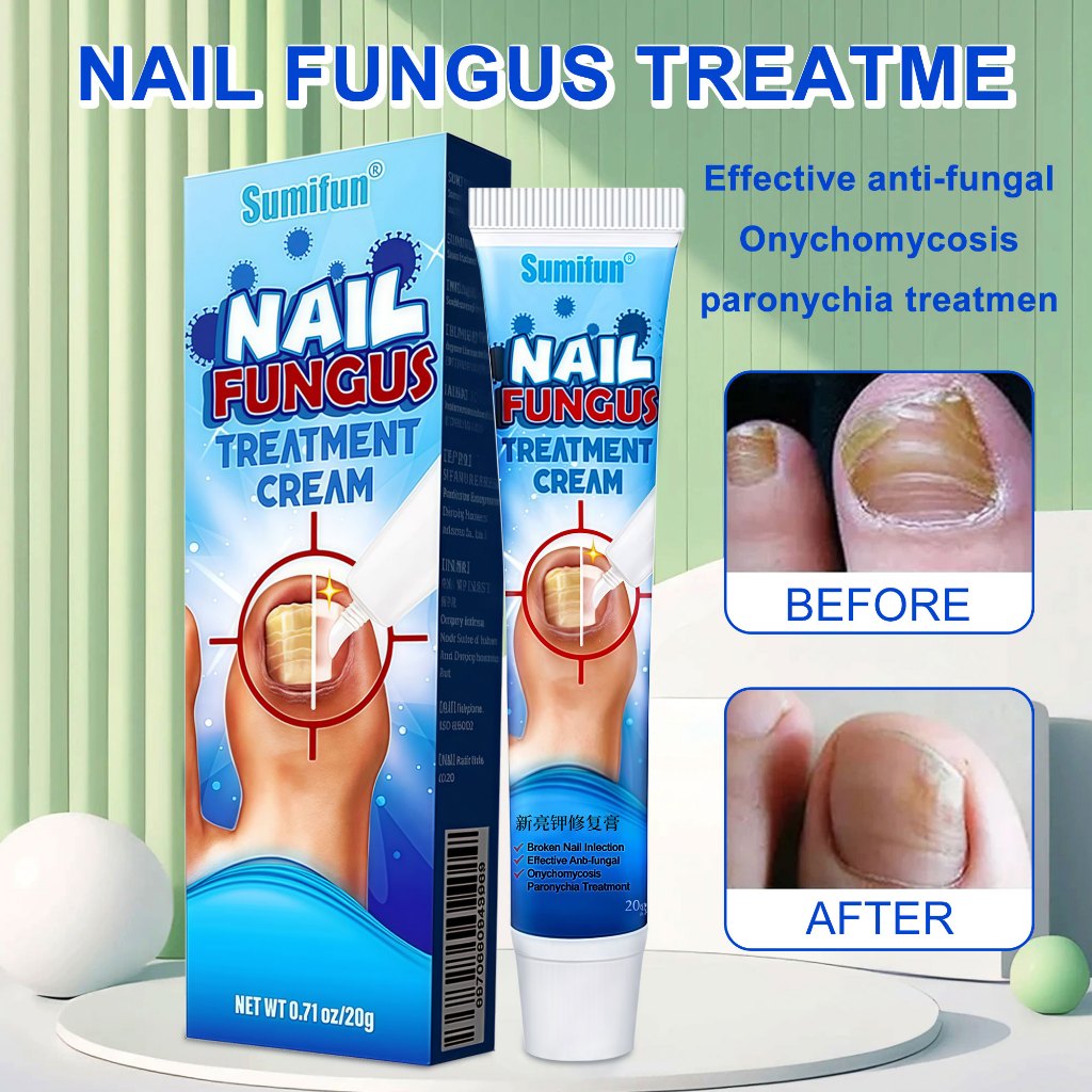 Sumifun Nail Fungus Treatment Cream – Effective Antifungal Solution for ...