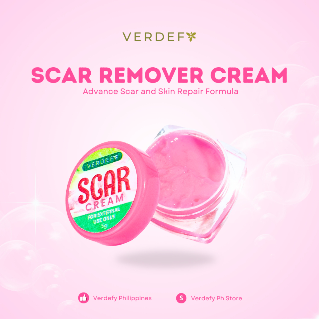 VERDEFY SCAR CREAM 5G FOR OLD & NEW SCAR KELOID STRETCH MARKS PIMPLE ...