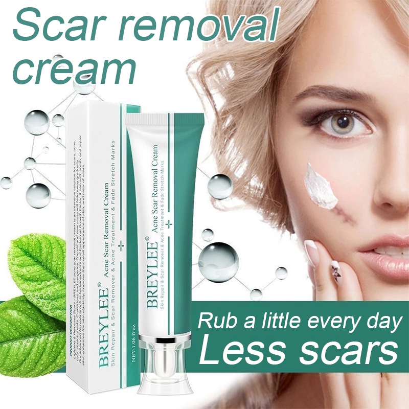 scar remover Trauma burns cesarean section hypertrophic scars scarsetc ...
