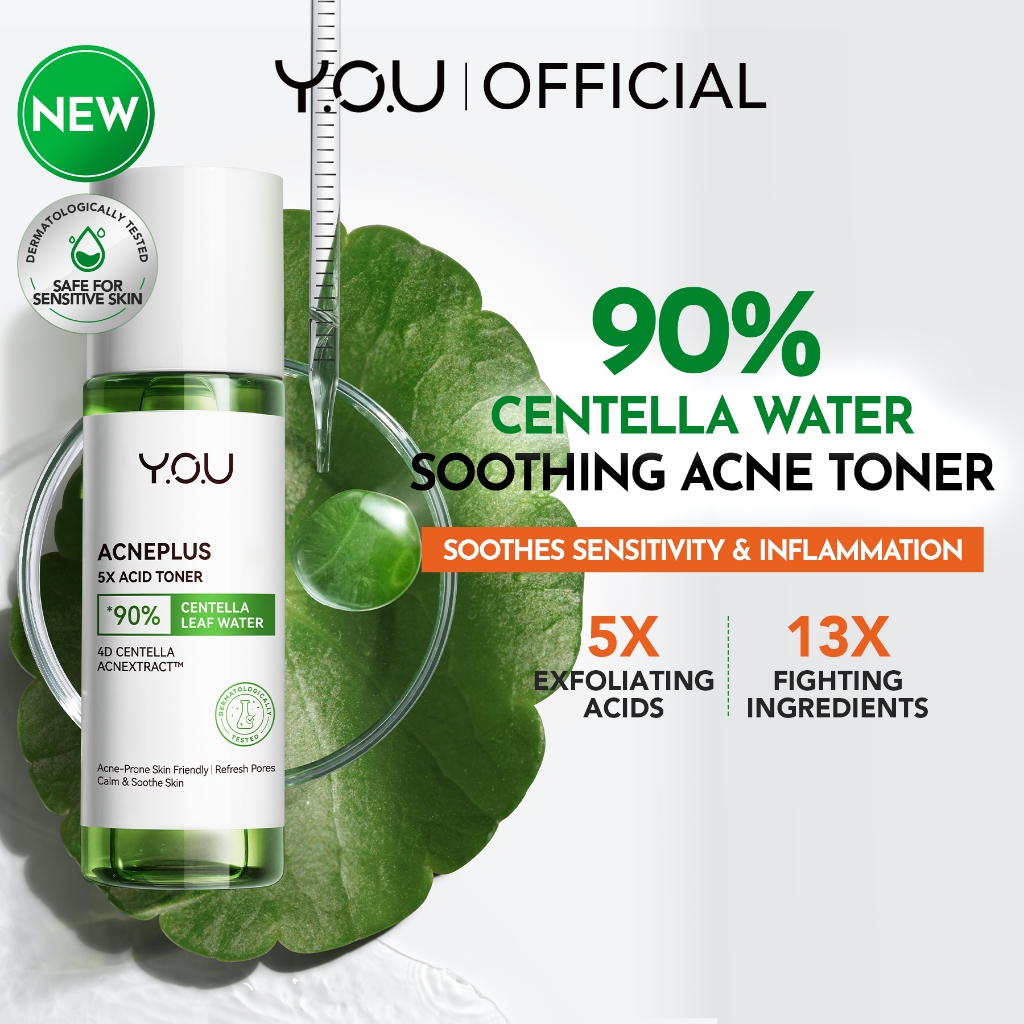 [NEW LAUNCH] Y.O.U AcnePlus 5X Acid Toner 80ml l Fights Acne Calms and ...