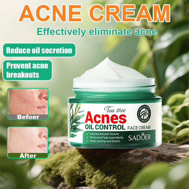 Pimple remover Anti pimples and acne Oil Control Shrink Pores Acne ...