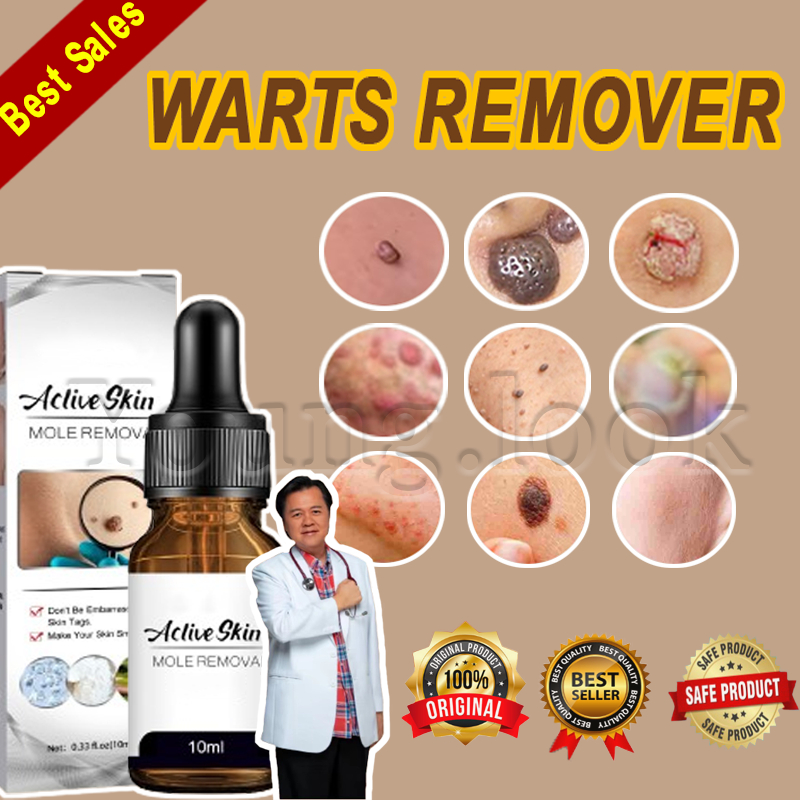 Warts Remover Solution Original Kasoy Oil Kulugo Skin Tags Mole ...