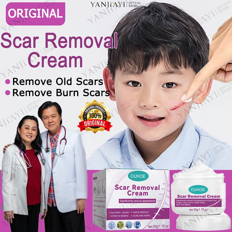 Scar Removal Cream Peklat Remover Acne Treatment Old Scar Remover Cream ...