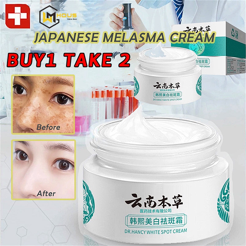Buy 1 take 2 Japanese Melasma Cream Whitening Cream for face remove ...