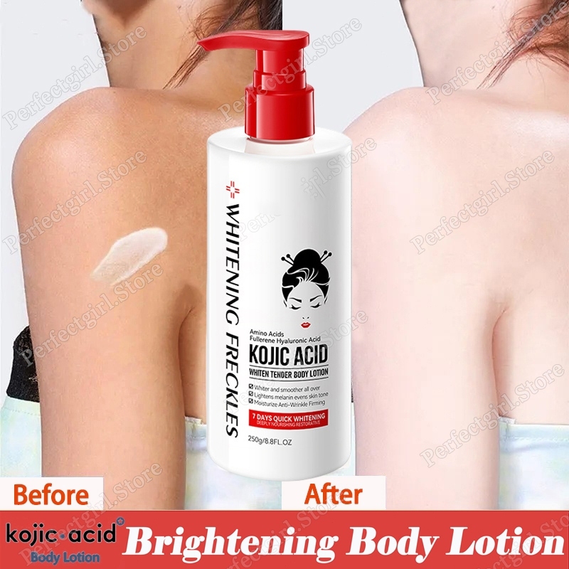 230ml Kojic Acid Body Lotion Moisturizing Lightening Improve Skin Body Lotion | Shopee Philippines