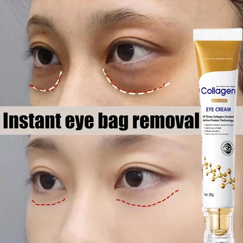 Collagen Eye Cream Anti Aging Eyebags Remover Cream Eye Care For Dark ...