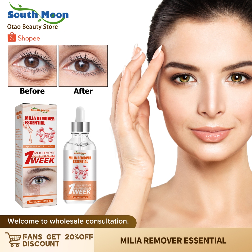 South Moon Milia Remover Essential 30ml Eye Fat Particles Removal ...