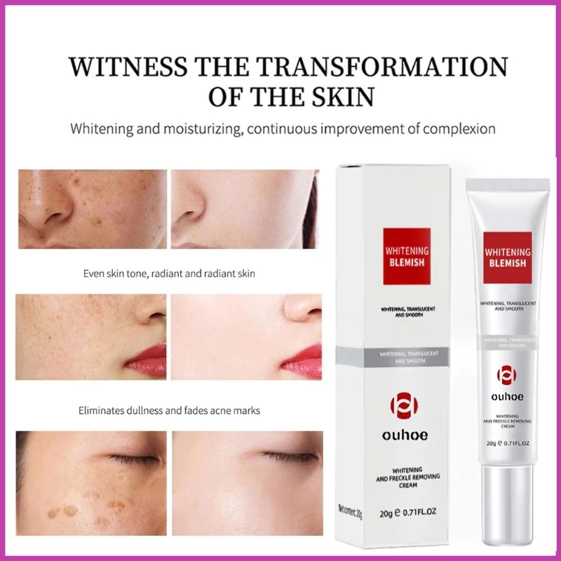 OUHOE Whitening Cream Dark Spot Remover Melasma Treatment Freckle ...