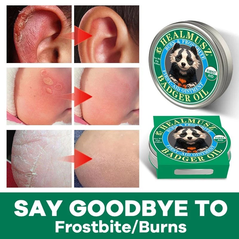 HEALMUSZ Badger Oil Burn & Frostbite Cream Pain Relief First-Aid ...
