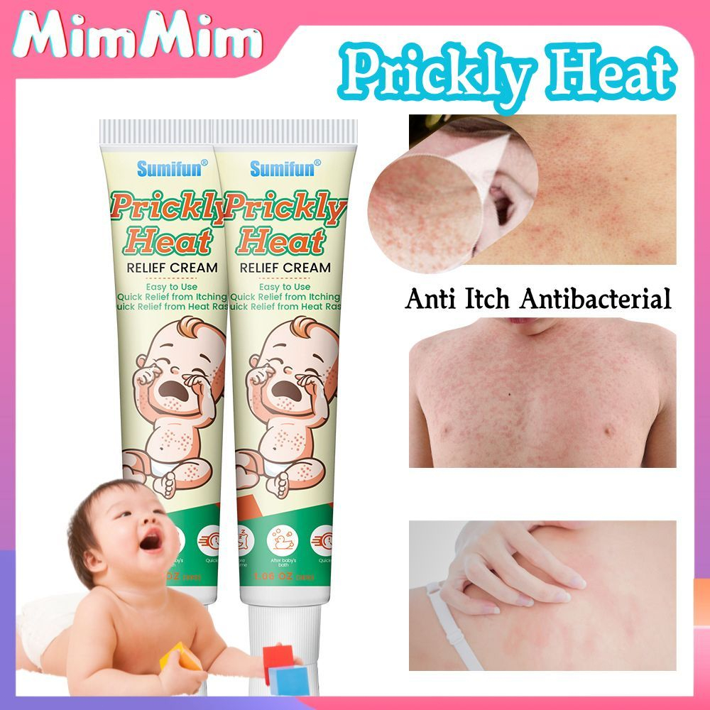 Prickly Heat Cream for baby Away Natural Soothing Gel Anti-Itch ...