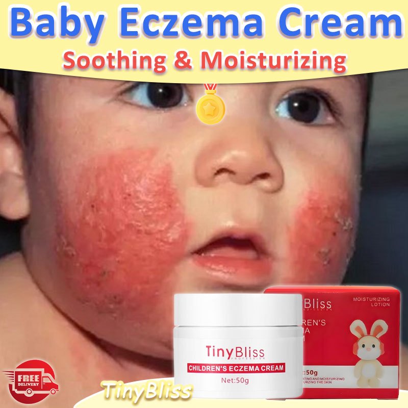 Tinybliss Eczema Cream For Baby50g Itch Relief Antiseptic Extra Gentle ...