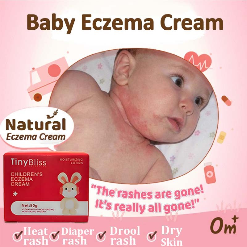 TinyBliss Baby Diaper Cream Rash Cream Nappy Rash Ointment Baby Anti ...