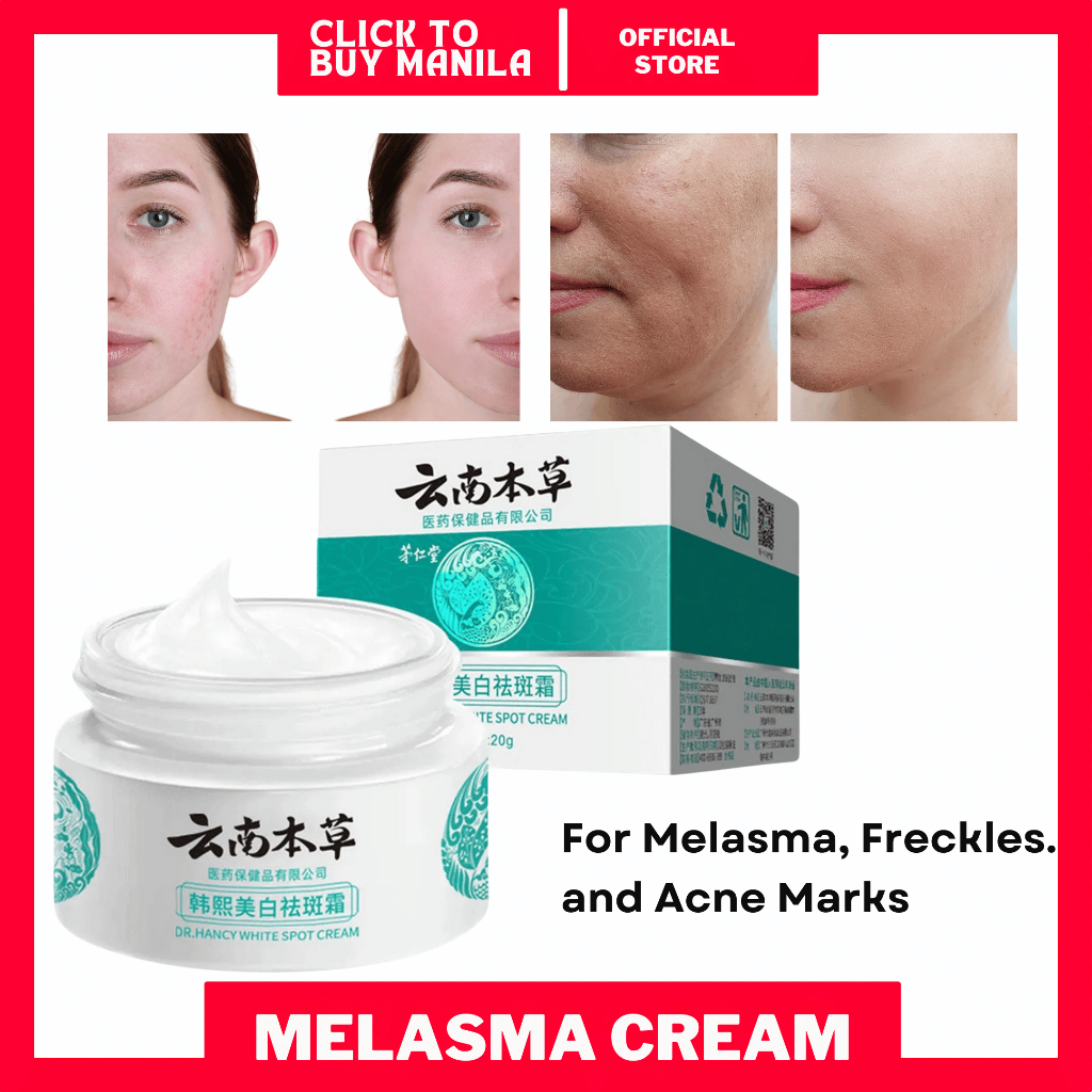Moisturizing Japanese Melasma Cream Original Whitening – Advanced Skin ...