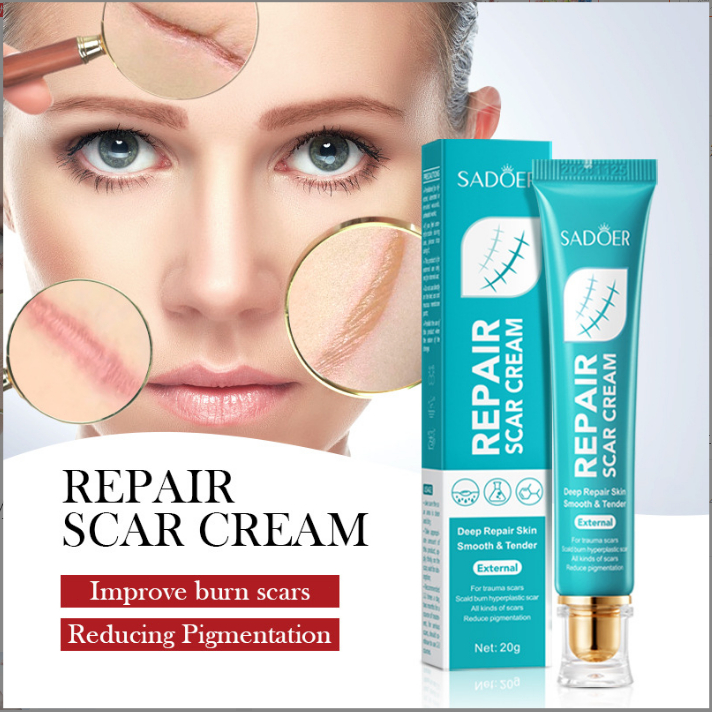 Scar Removal Cream Old Scar Stretch Mark Remover Cream Effective Acne ...